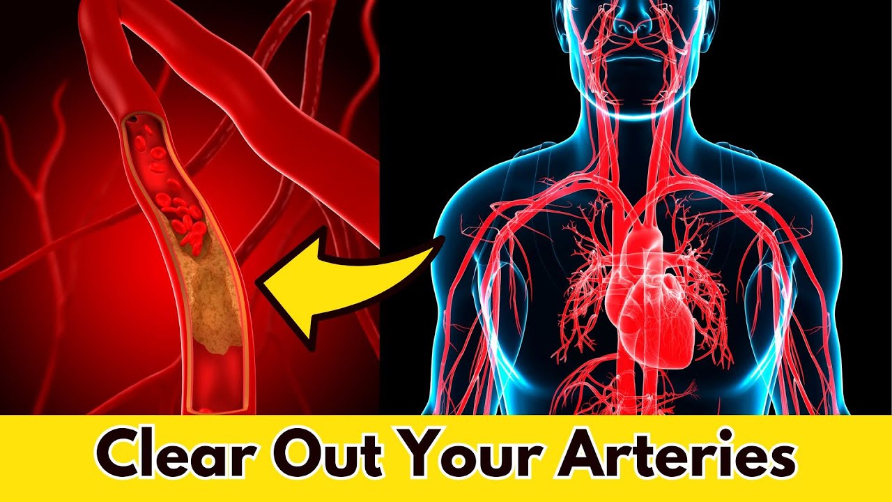 Best Remedies to Clear Out Your Arteries - YouTube