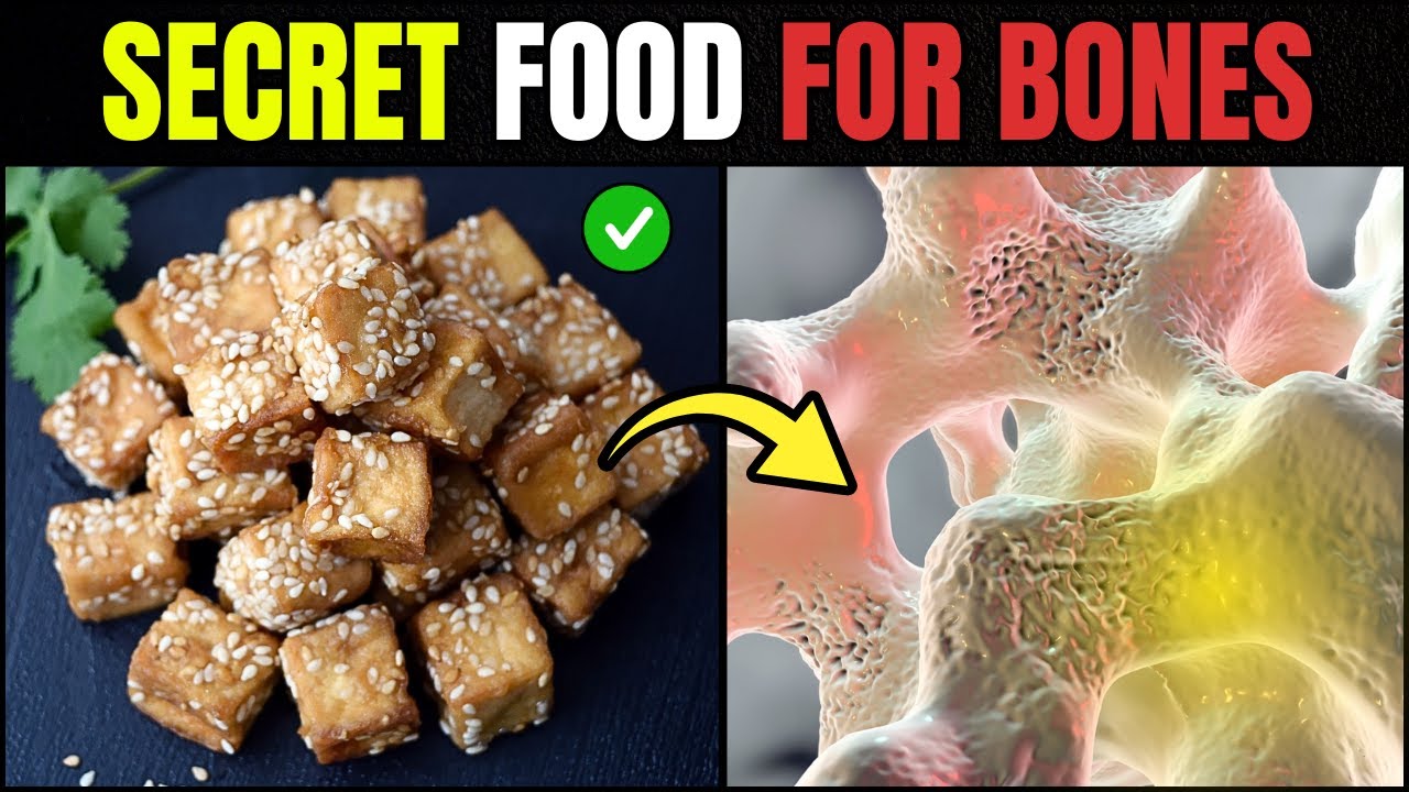 These Surprising Foods Can Boost Bone Strength and Fight Osteoporosis ...