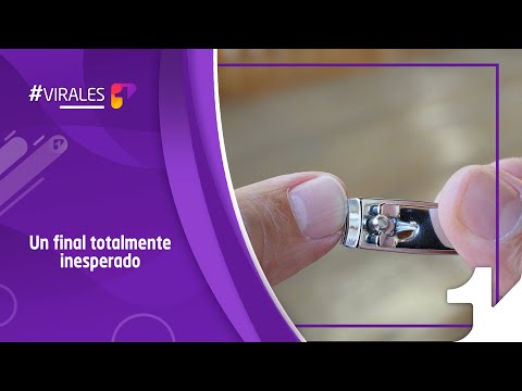 Joven vivió 10 años con una mancha en la uña, pero descubrió que era cáncer