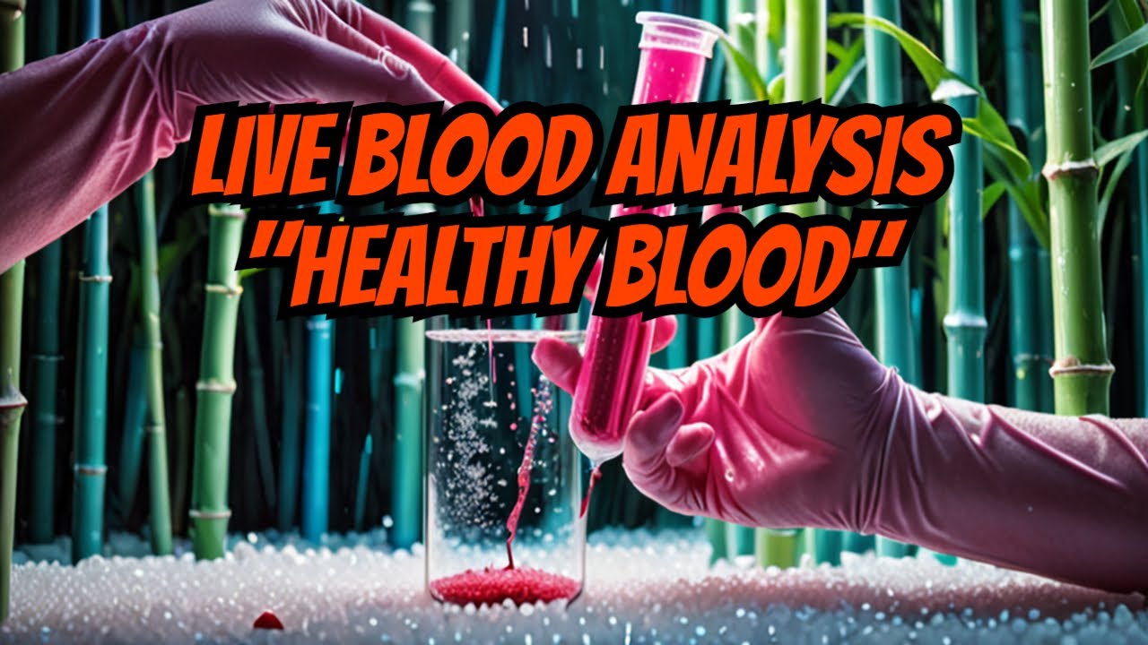 Fascinating video on live blood analysis - YouTube