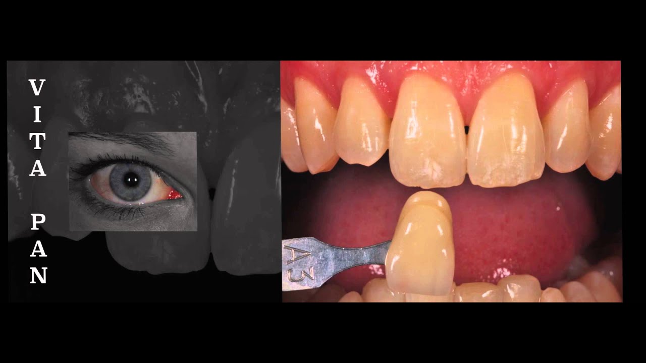 Shade selection tip - YouTube