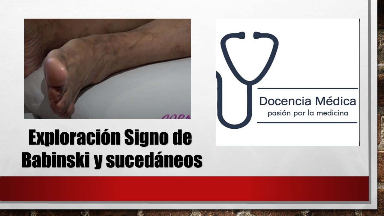 Exploración de Signo de Babinski y Sucedáneos - YouTube