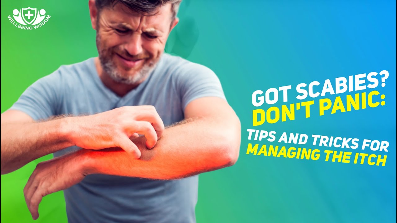 Got Scabies Don't Panic Tips and Tricks for Managing the Itch - YouTube