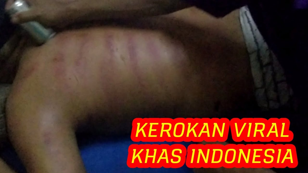 Kerokan Viral Kas Orang Indoonesia Jawa Tengah Youtube