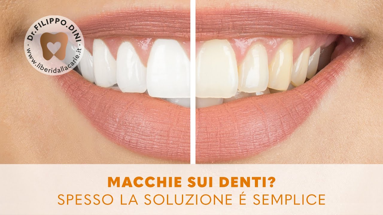 Macchie sui denti? Spesso la soluzione è semplice. - YouTube
