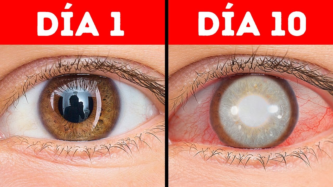 ¿Qué pasa si no parpadeas? - YouTube