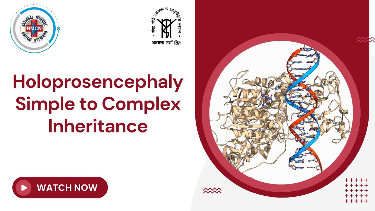 Holoprosencephaly Simple to Complex Inheritance - YouTube