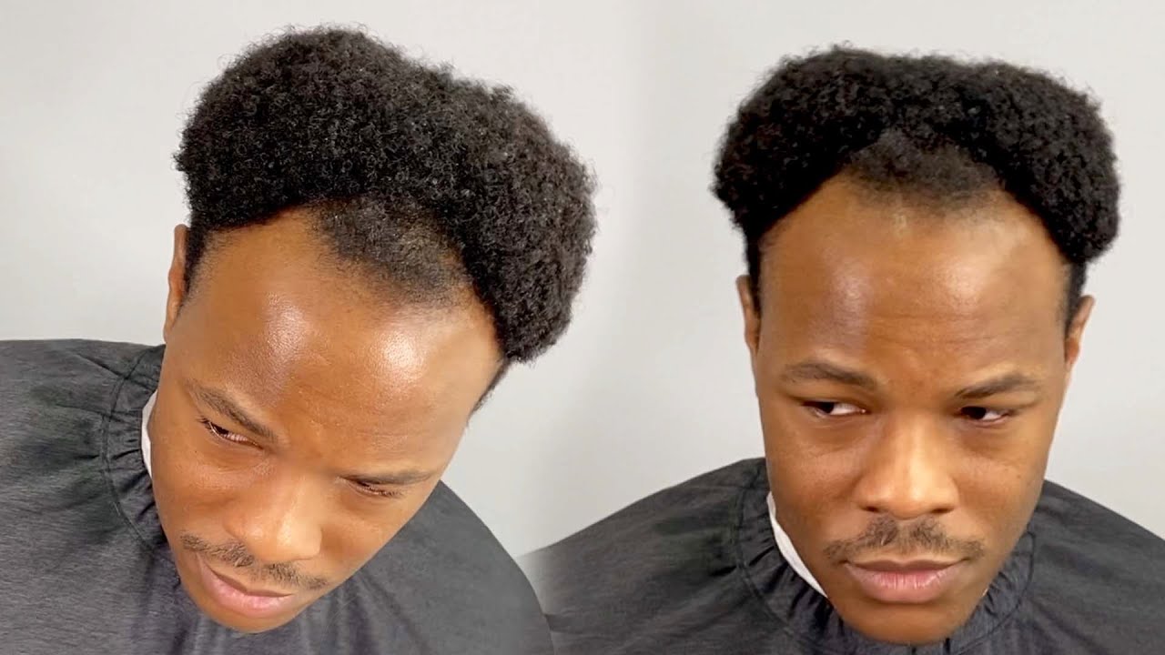 Best Hairline Jokes