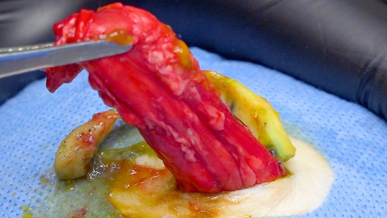 Dr. Lee Geoff Butler Enilsa MrPopZit 🌝 Professional pedicure process ...