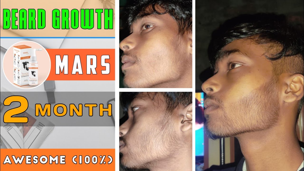 BEARD GROWTH || 65 days done √ Grow your full beard in 2 month || 100% ...