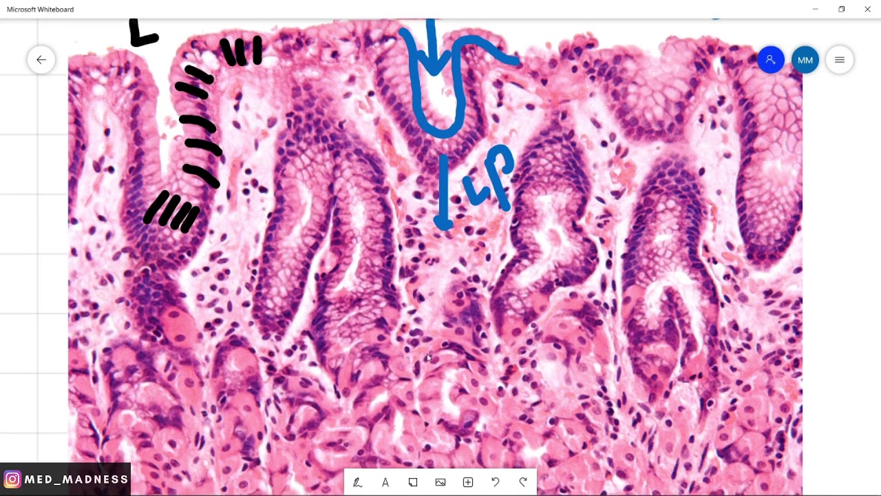 Stomach Histology Slide Understanding Stomach Mucosa Med Madness Youtube