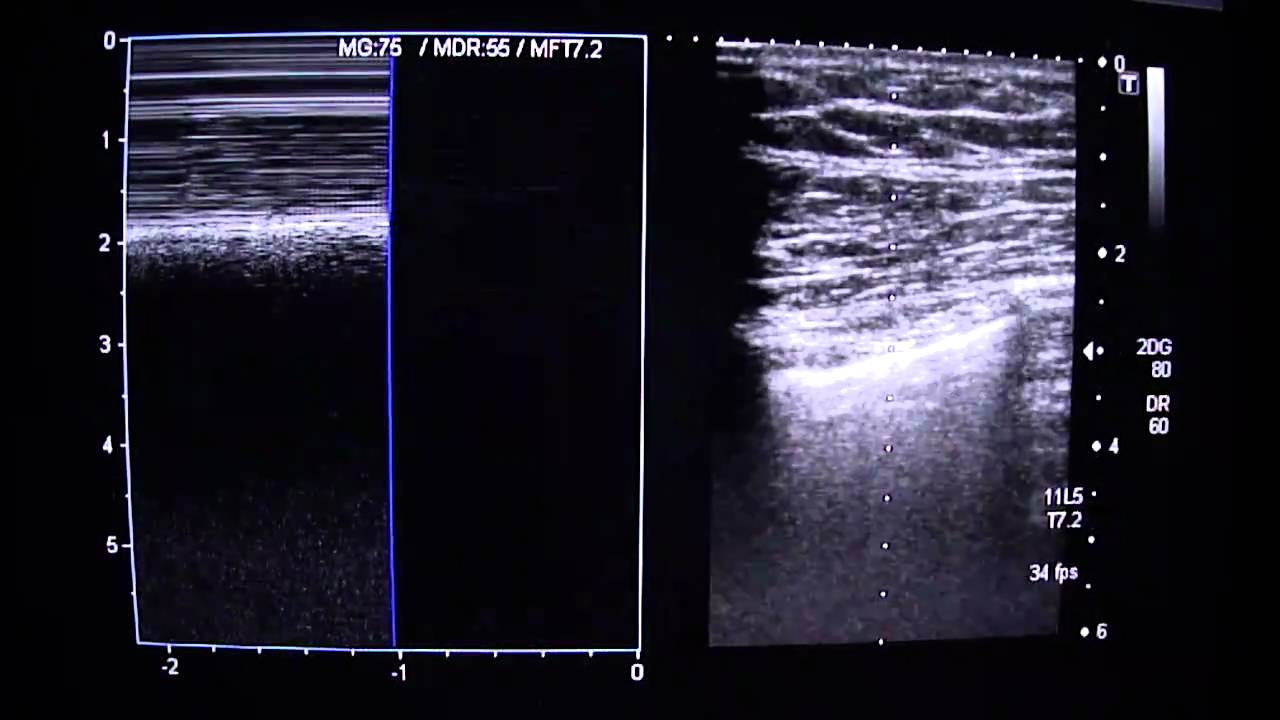 Seashore Sign.MP4 - YouTube