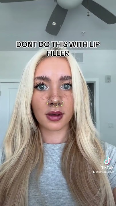 What Happened To My Face Kaylamalecc Shorts Youtube
