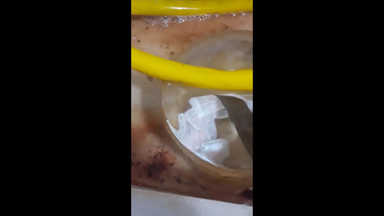 tissues processing and fixation. most helpfull video watch up to end ...