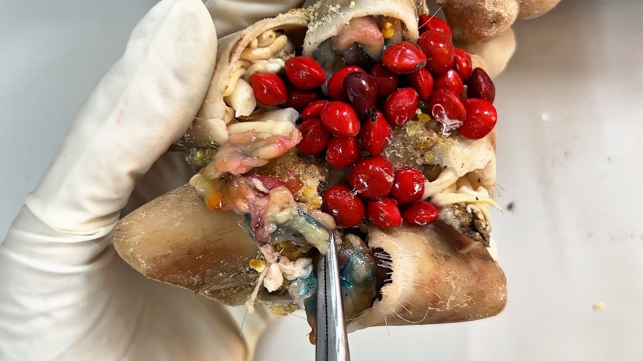 CUT Ingrown Toenails 👣 Toenails with Maggots, Fungal Toenails ...