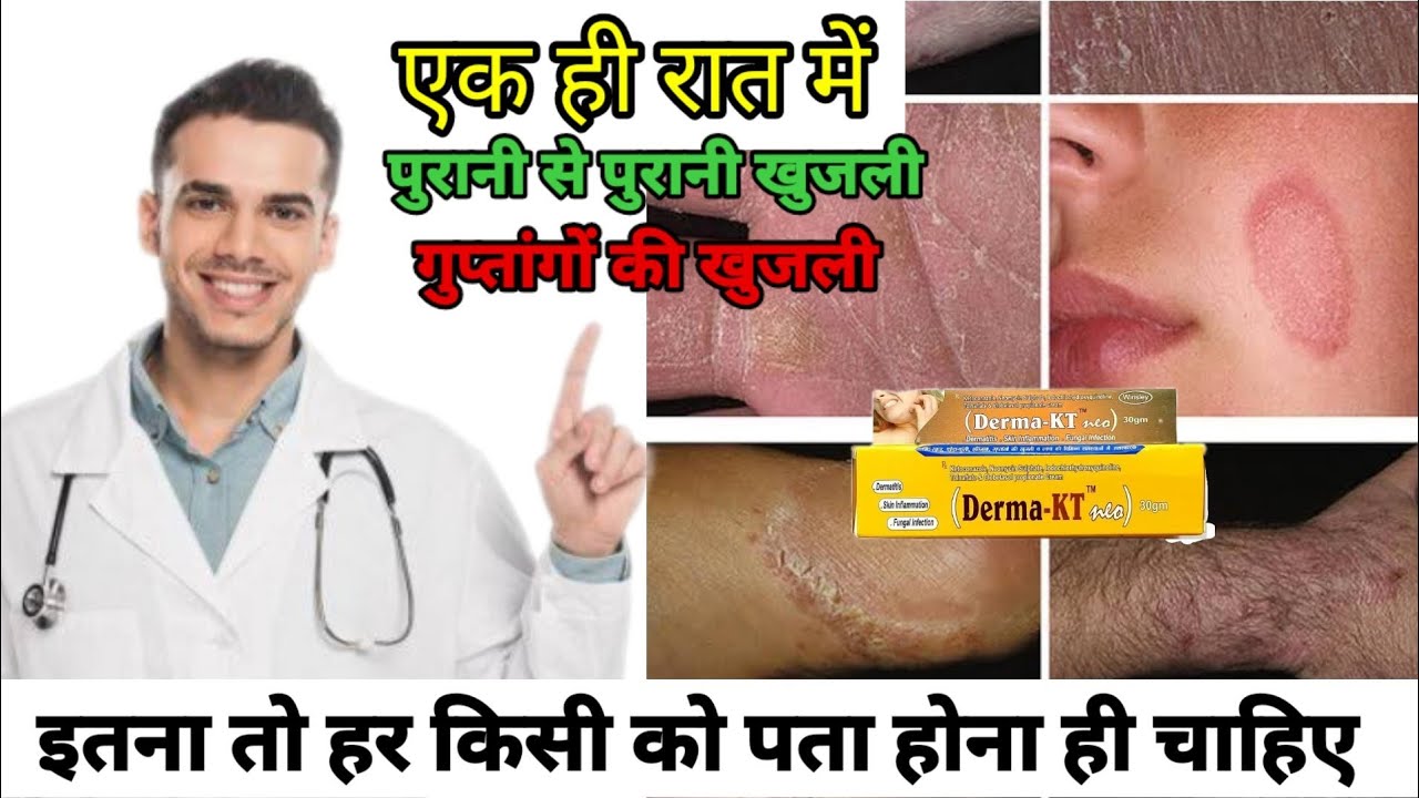 Derma KT skin cream - Allergy cream full review - Fungal infection ...