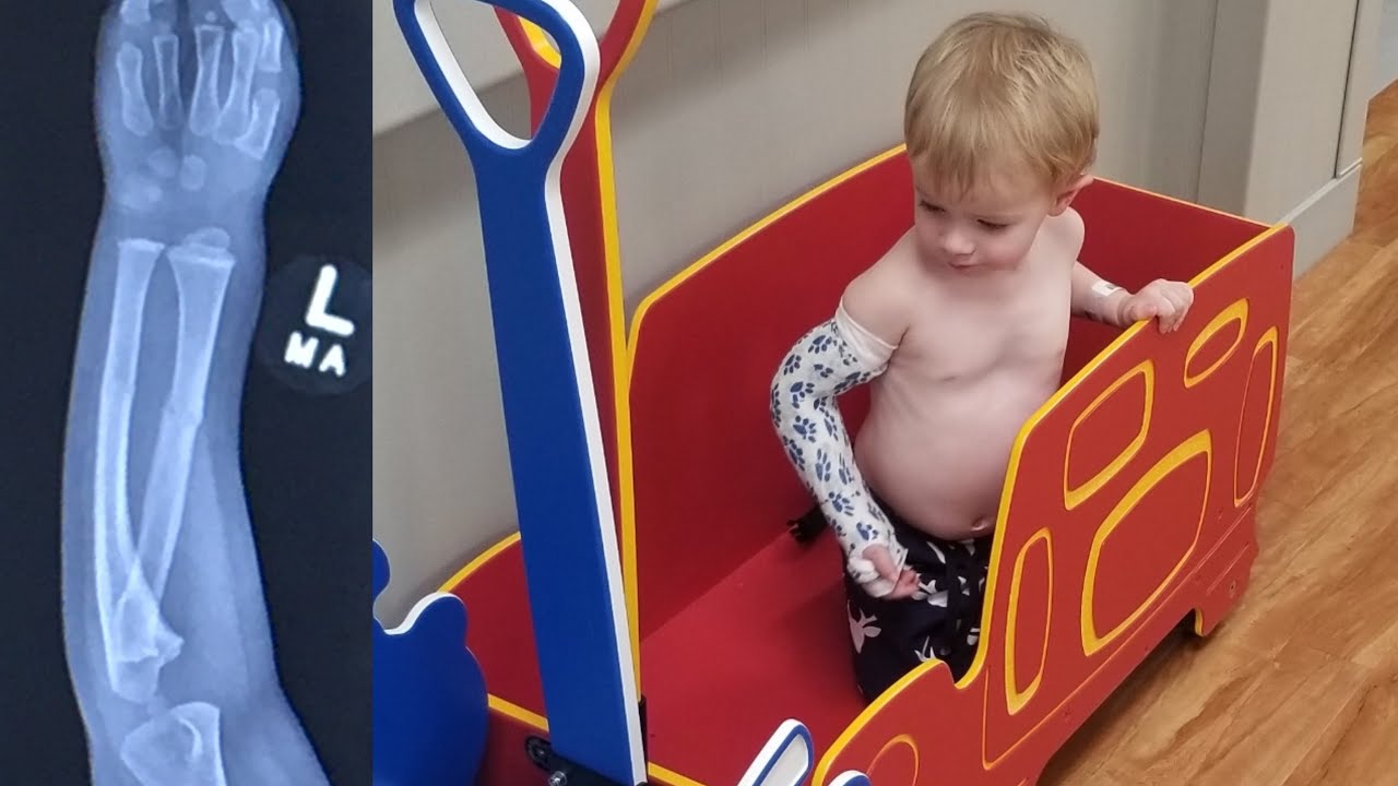 Noah broke his arm 😢 & The Aftermath - YouTube