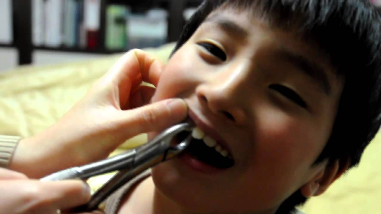Pull a tooth out at home - YouTube