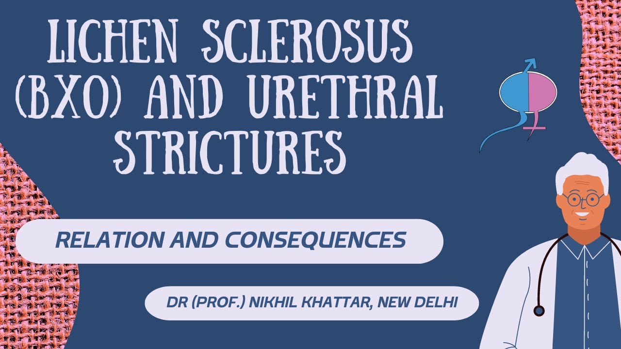 Genital Lichen Sclerosus / BXO and Urethral Stricture in Men - YouTube