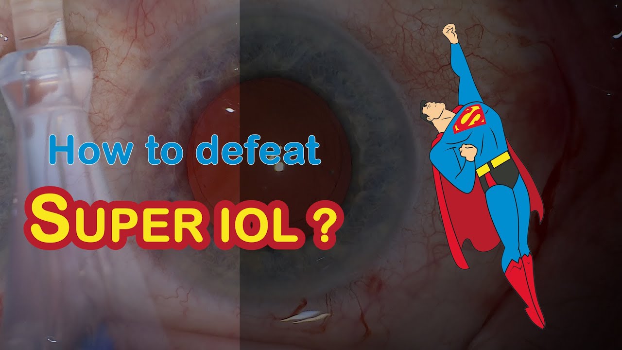 How to defeat Super IOL ? - YouTube