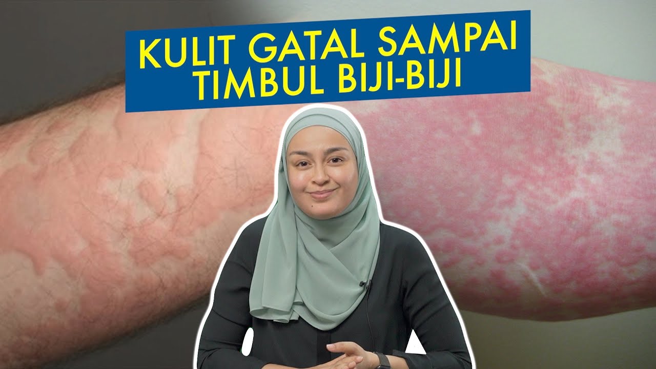 Kulit Gatal Sampai Timbul Biji-Biji - YouTube