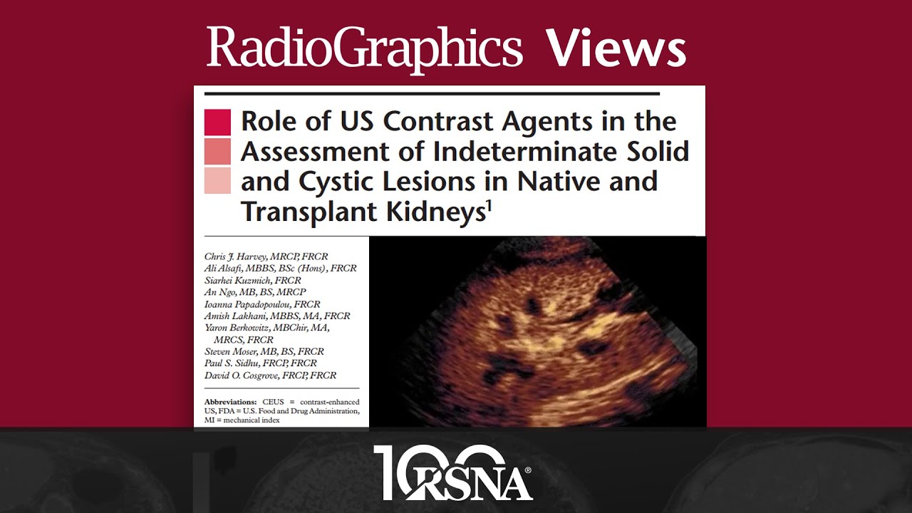 US Contrast Agents to Assess Renal Lesions in Native and Transplant ...