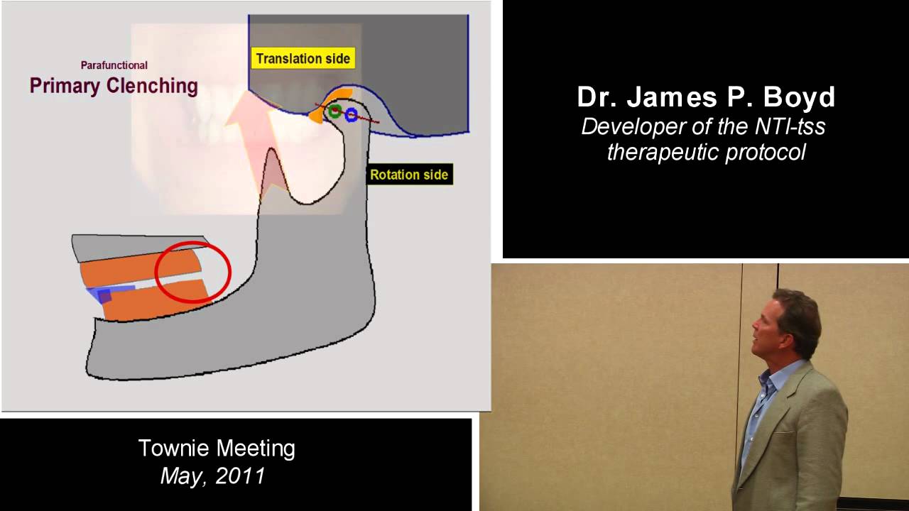 11 Avoid Excessive VDO in Protrusive Excursions - YouTube