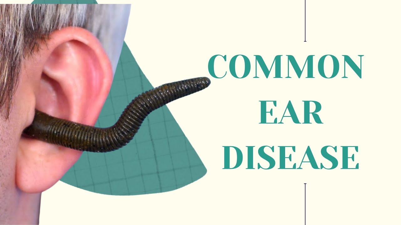COMMON EAR DISEASE | HPSF ORL AWARENESS WEEK 2021 - YouTube
