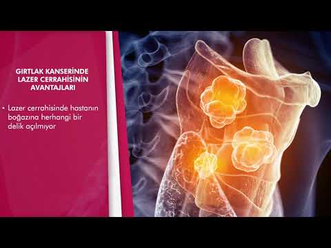 Gırtlak kanserinde lazer tedavisi nasıl uygulanıyor? - Prof. Dr. Ümit Tunçel