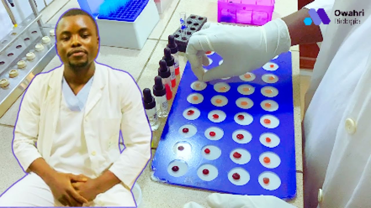 Technique de Groupage Sanguin Système ABO et Rhésus D : Méthode de BETH ...