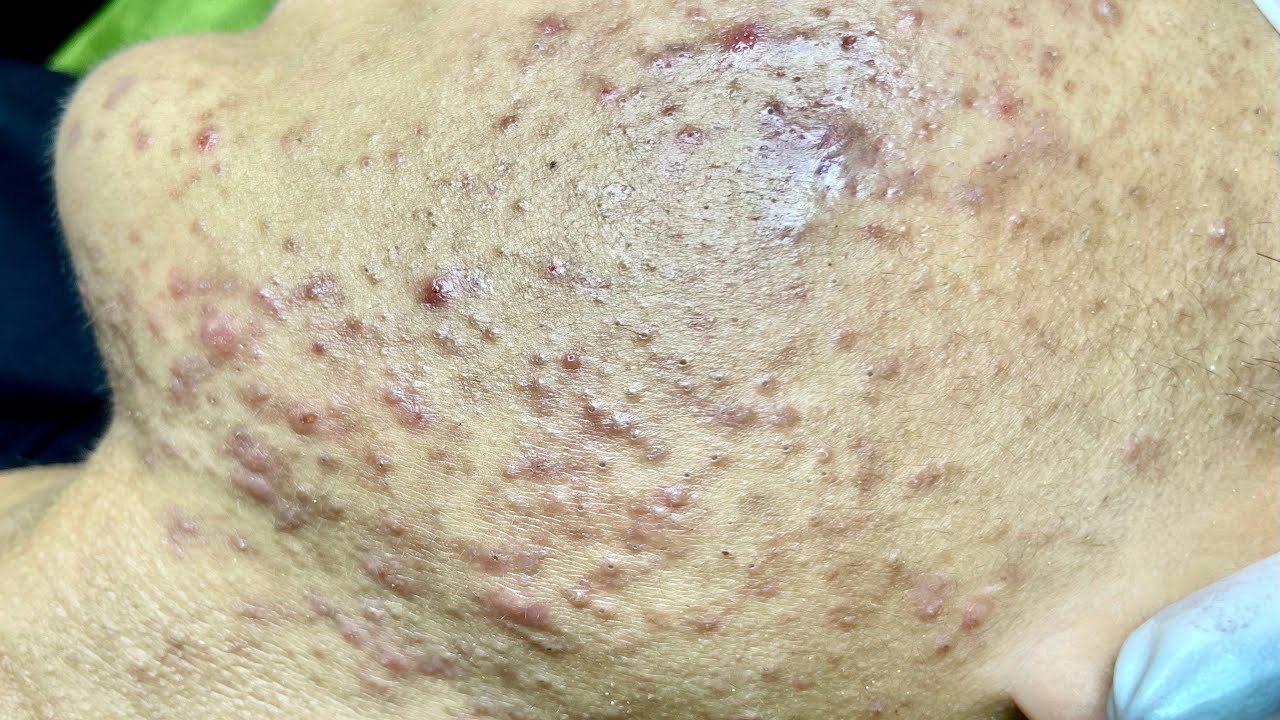 Satisfying video with Chung Vo Spa | 375 - YouTube