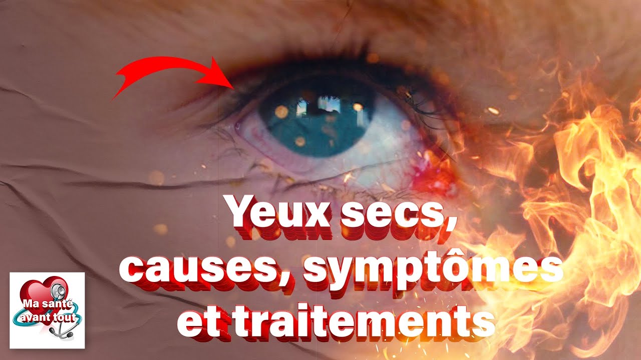 ️Les Yeux secs, découvrez les causes, symptômes et traitements ️ ️ ️# ...