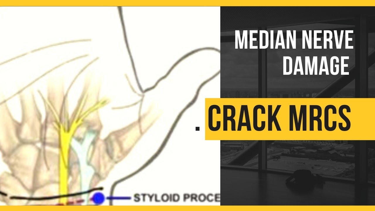 Median nerve damage MRCS question solve (CRACK MRCS) - YouTube