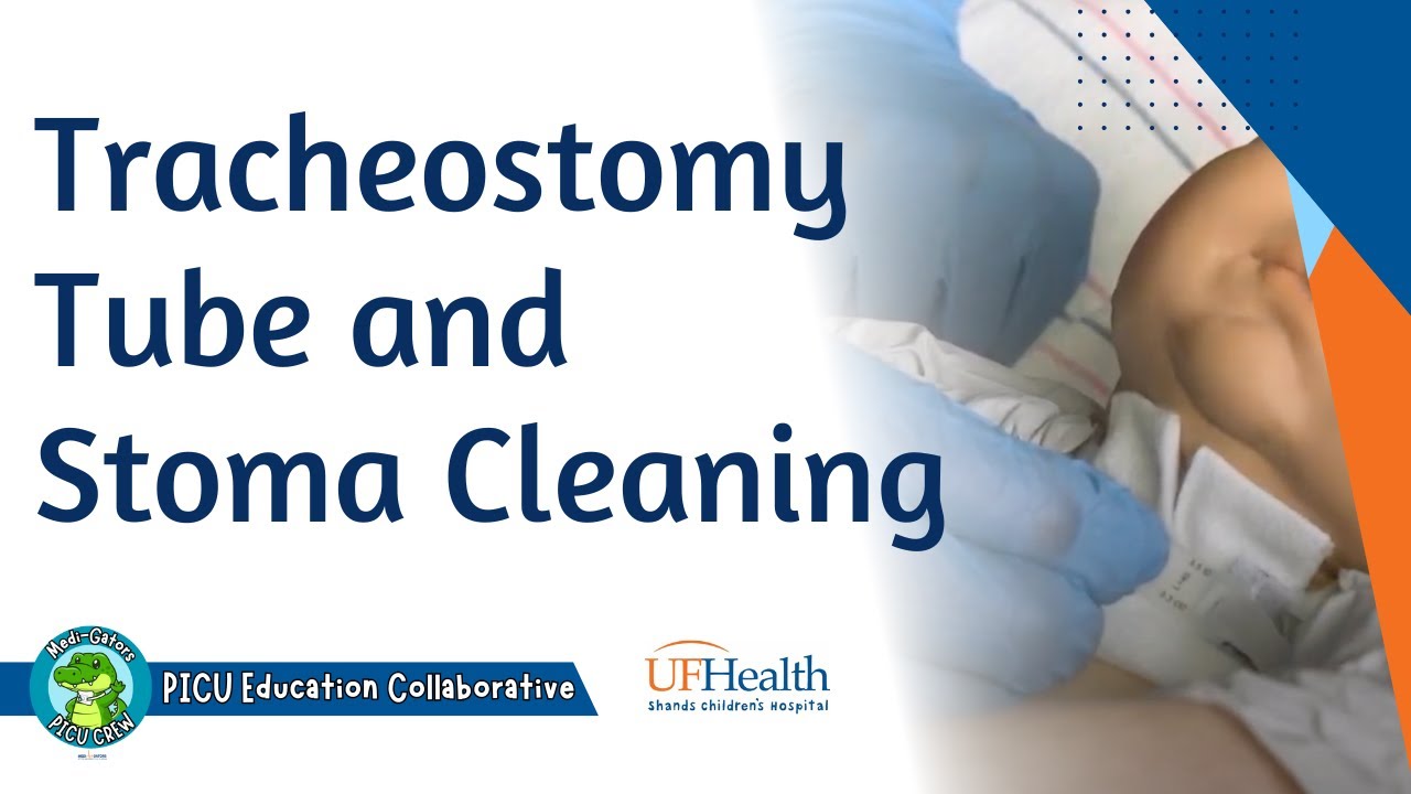 Tracheostomy Tube and Stoma Cleaning - PICU Education Collaborative ...