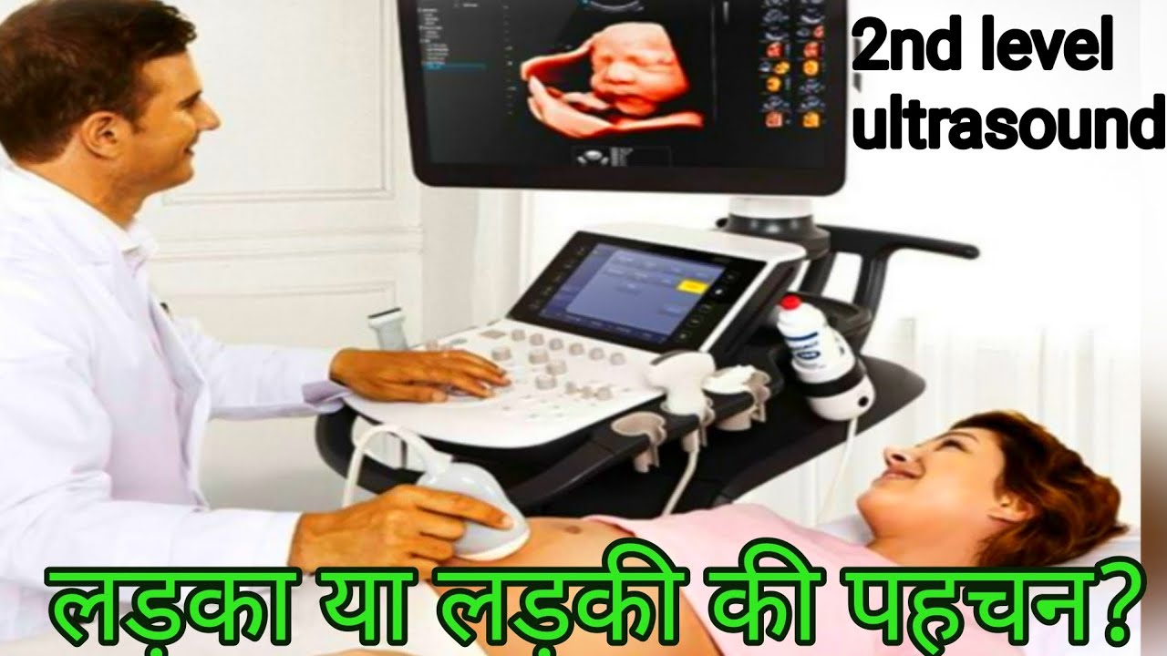 🤱🥰Ultrasound se Jane ladka ya ladki/Sonography se kaise Jane ladka hai ...
