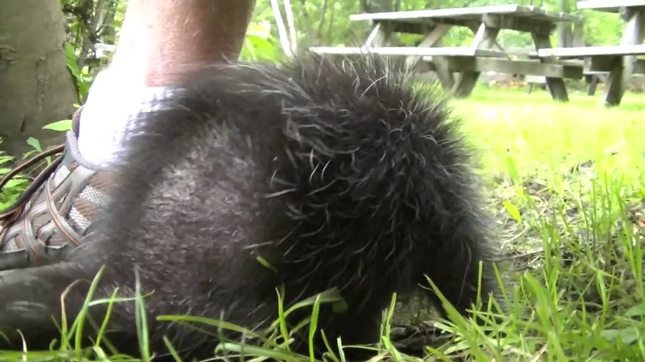 Human Porcupine Attack