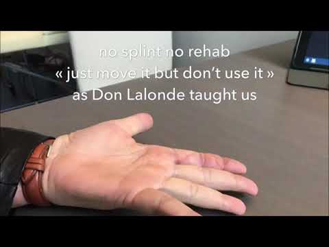 late FDP repair video by Thomas APARD - YouTube