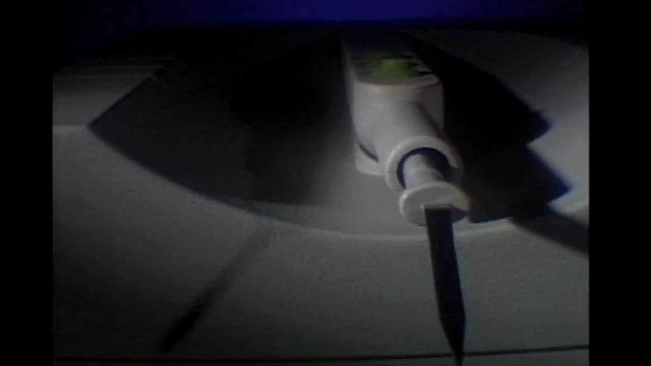 ConMed/Birtcher - Introducing The Hyfrecator Plus® - YouTube