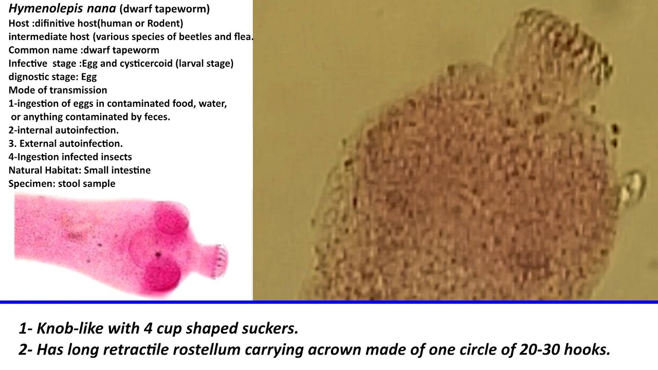 Hymenolepis Diminuta Scolex Tapeworms Wikimedia Commons