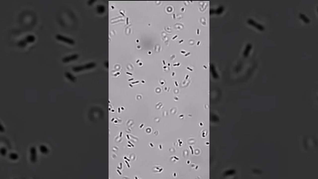 Tumbling motility In Listeria monocytogenes |Captured By Jitendra Kumar ...