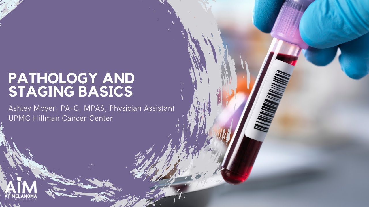 Pathology and Staging Basics - YouTube
