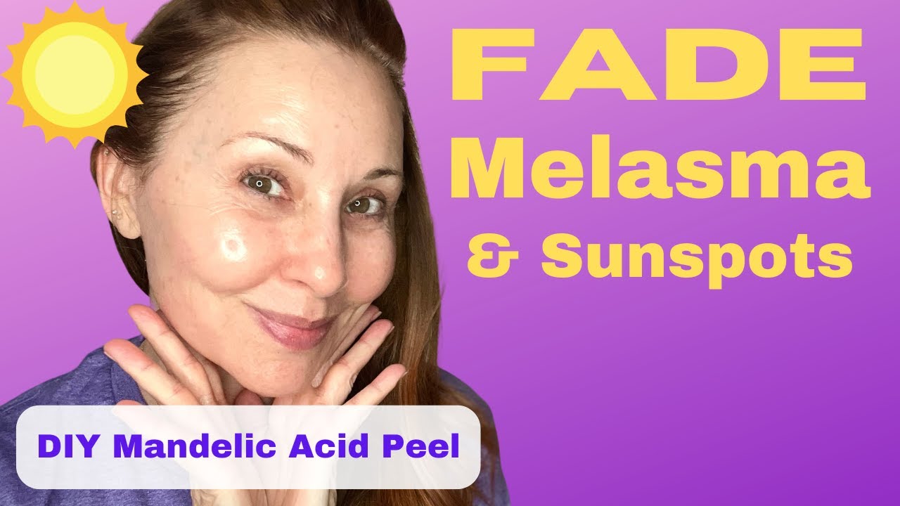 Fade Melasma & Sunspots on a Budget - YouTube