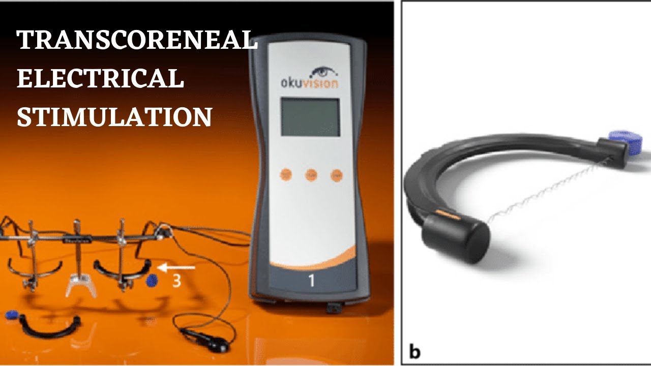 Transcorneal Electrical Stimulation Therapy for Progressive Retinal ...