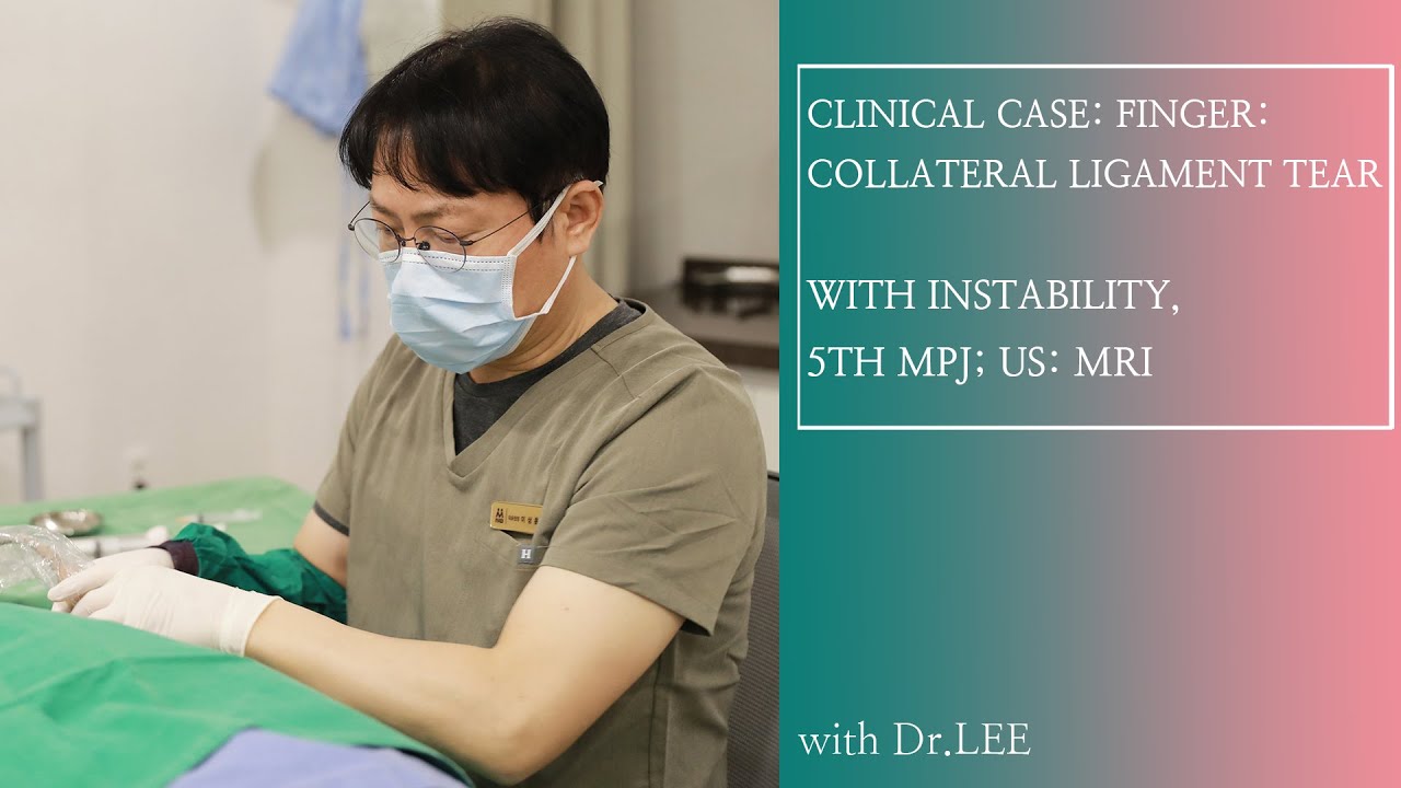 Clinical case: finger: whole blood therapy. collateral ligament tear ...