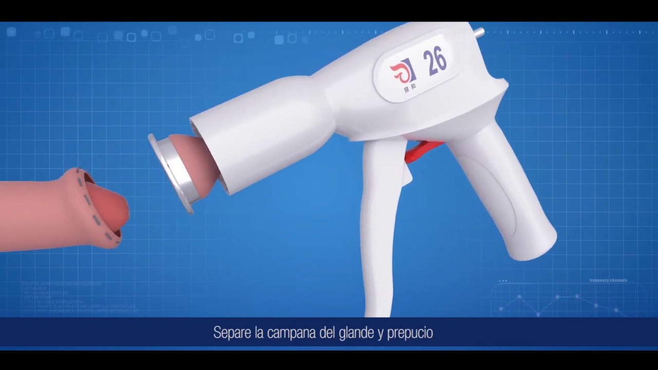 LangHe Medical - CircCurer - Sistema de sutura automatica ajustable de ...