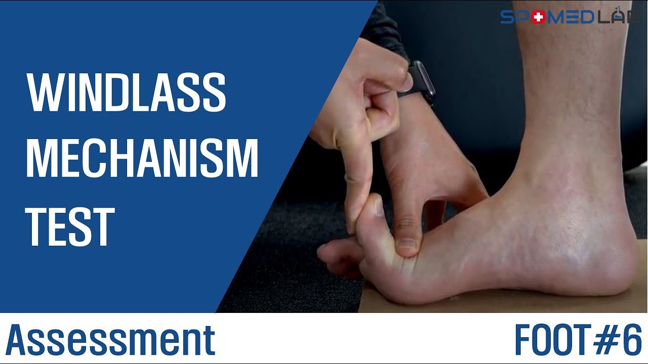 Windlass Mechanism Test I 족저근막염 평가 I foot#6 - YouTube