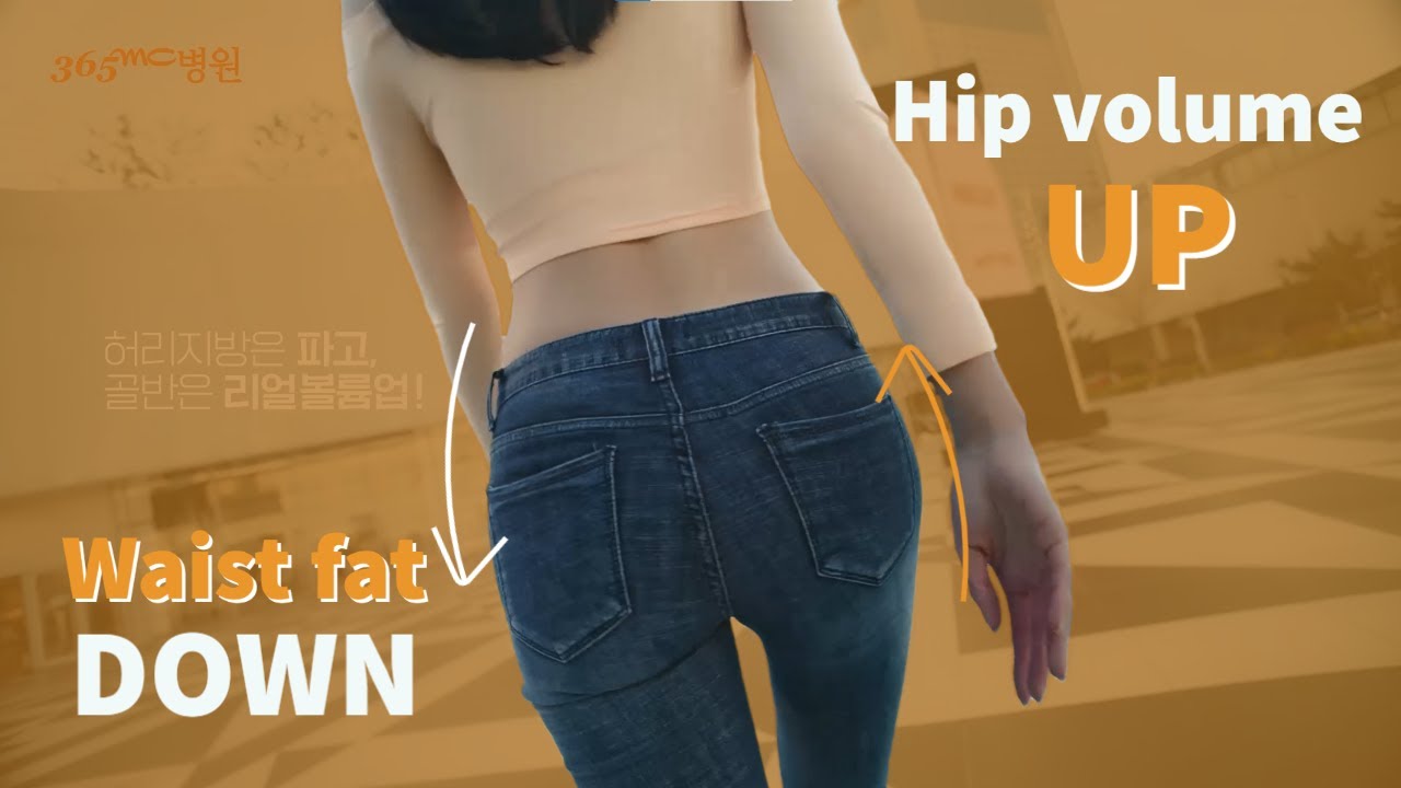 #365mc | Liposuction | Fat Graft to Hip | Waist fat is removed, hip ...