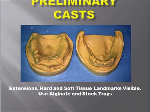Fall 2020 ; Prosthesis 7 ; Lec 4 ; Primary and secondary impression ...