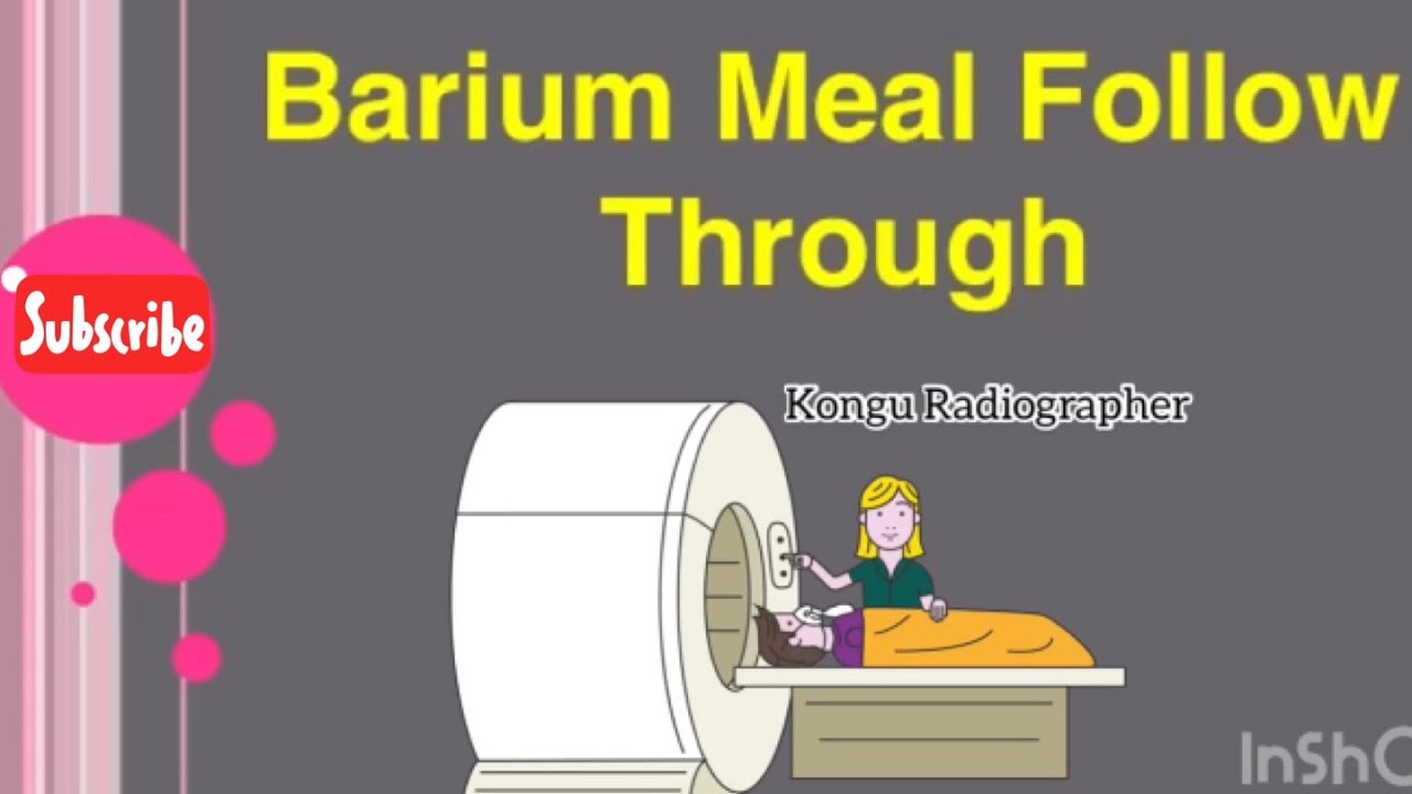 Barium Meal Follow Through Radiological Procedure Radiographer Barium Meal Follow Through Radiological Procedure Radiographer