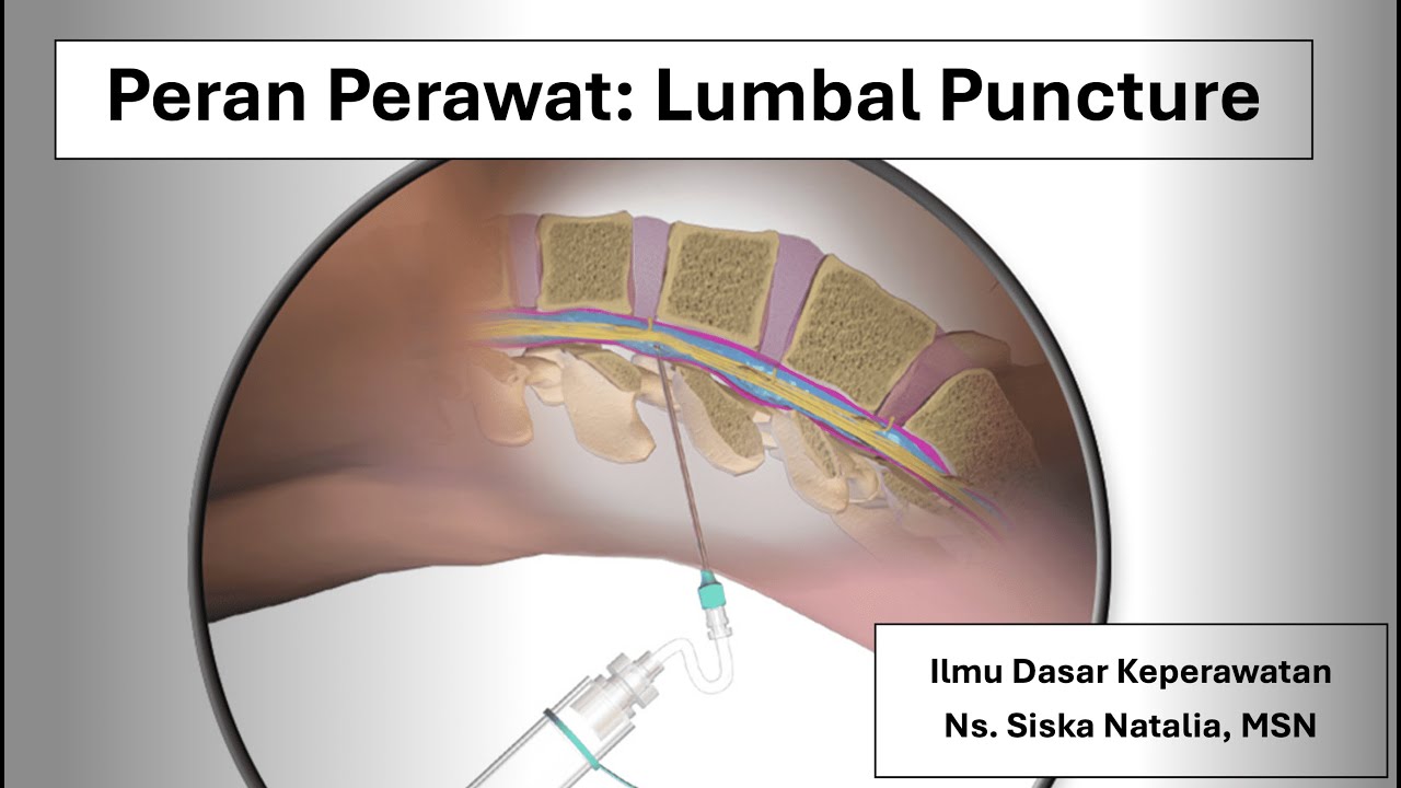 IDK Peran Perawat Lumbal Puncture/Pungsi Lumbal - YouTube